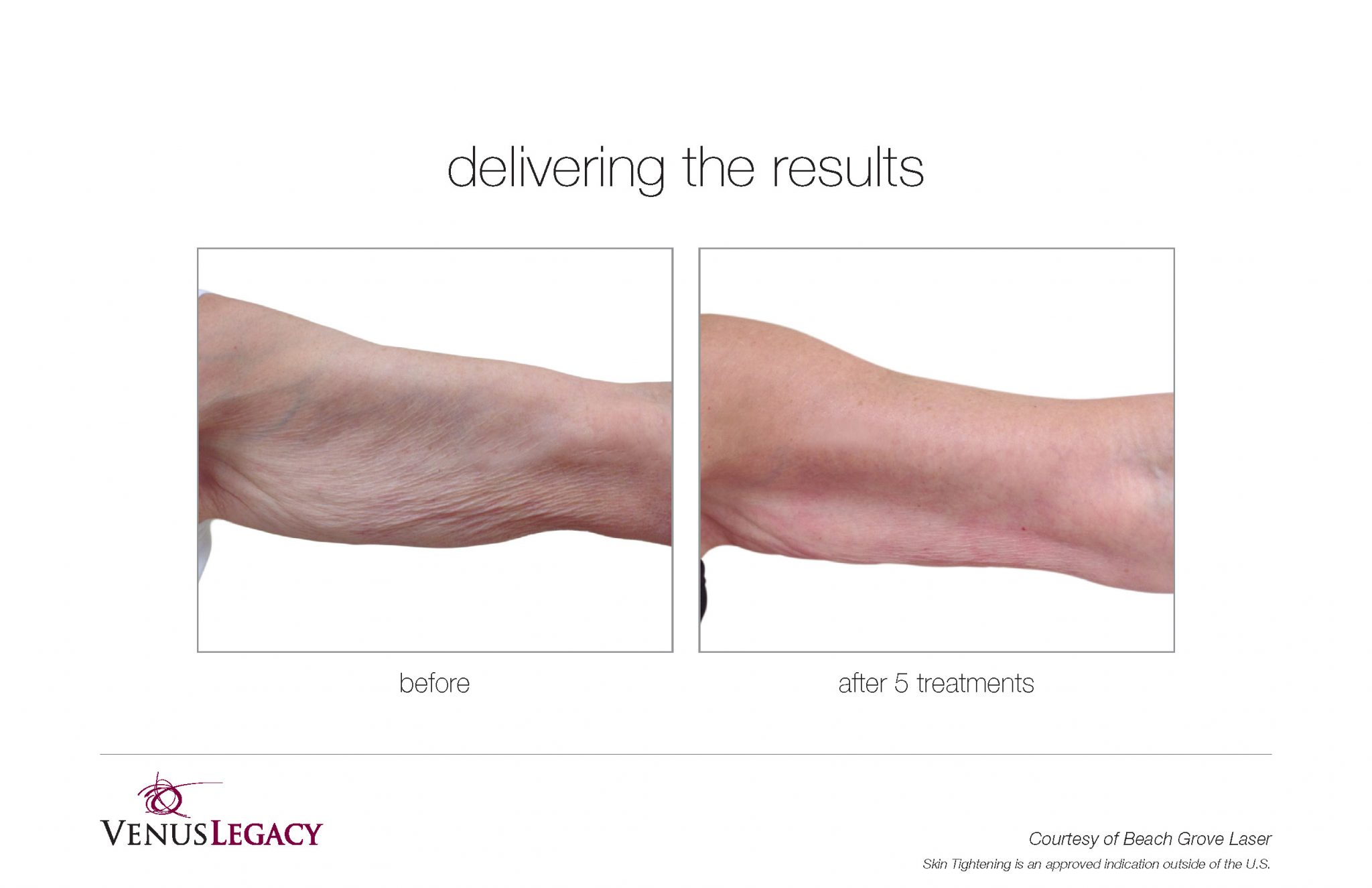 Venus Legacy Doctor NJ Dr. Betty Keller